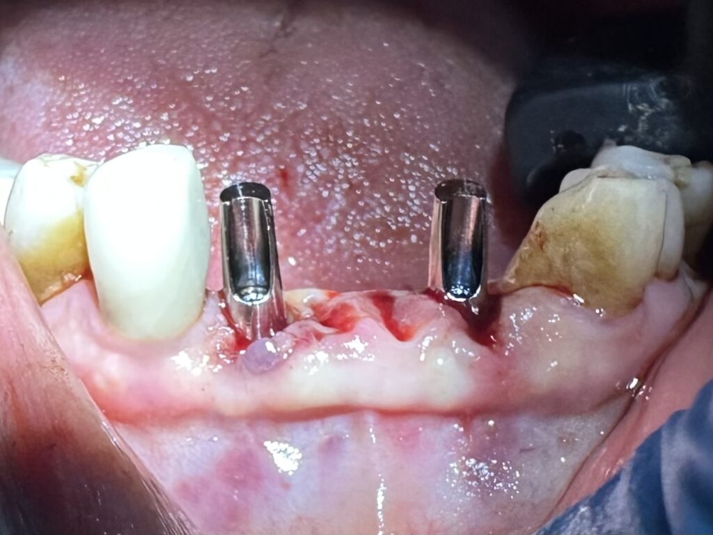 Patient Cases – Dr. Charles Chow